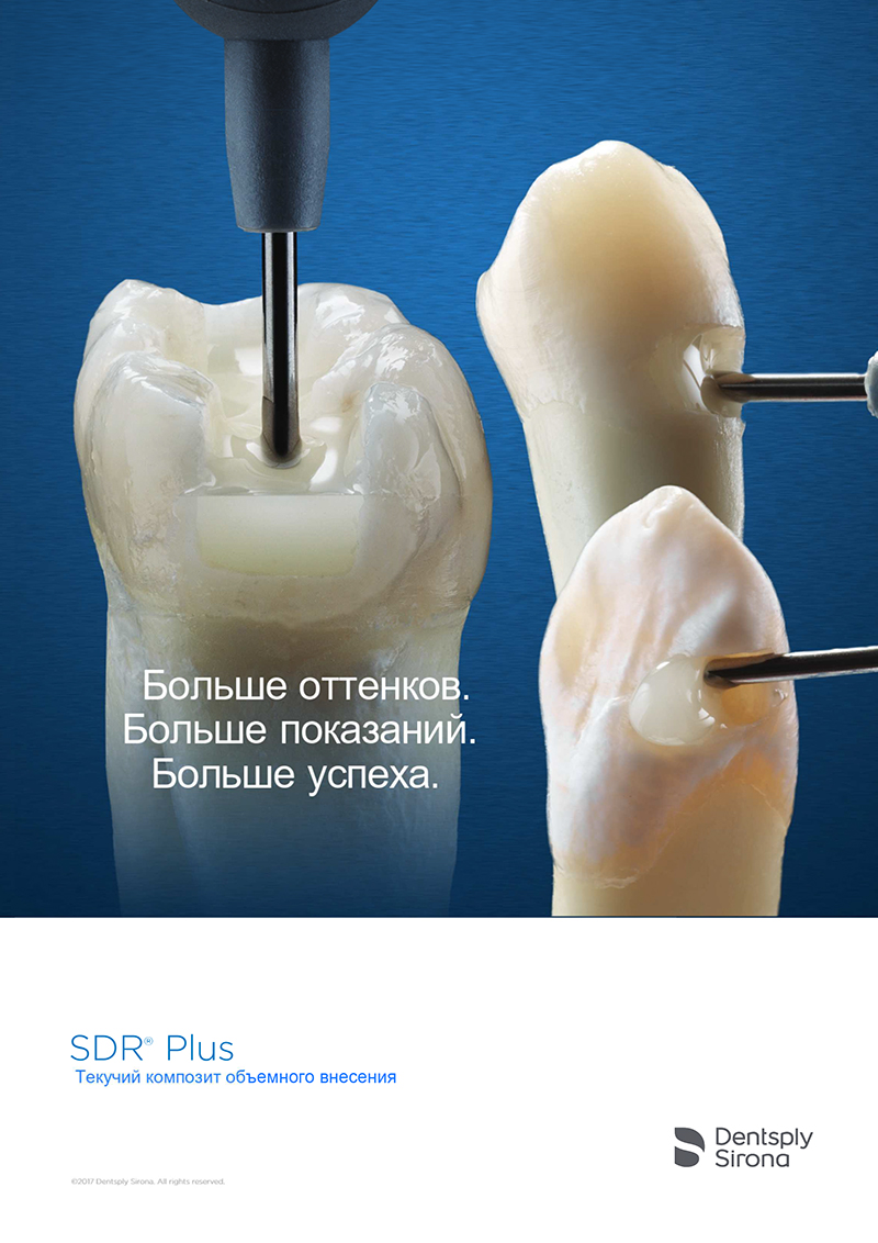 SDR Plus, капсула 0,25 г, оттенок универсальный, текучий композитный материал (СДР Плюс SDR Fill ...