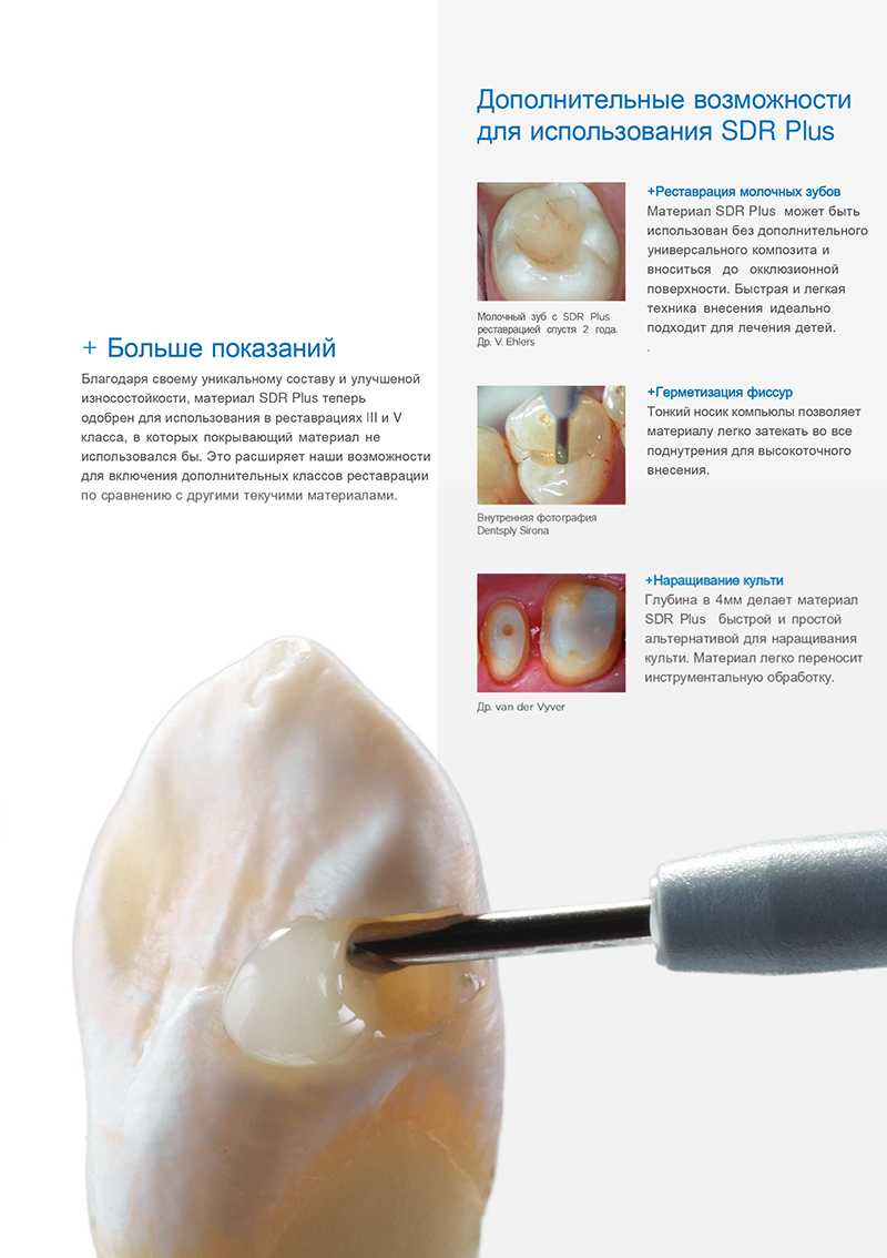 SDR Plus, капсула 0,25 г, оттенок универсальный, текучий композитный материал (СДР Плюс SDR Fill ...